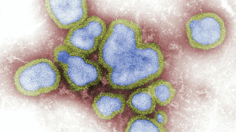 San Francisco sees spike in multiple viruses as doctors track causes
