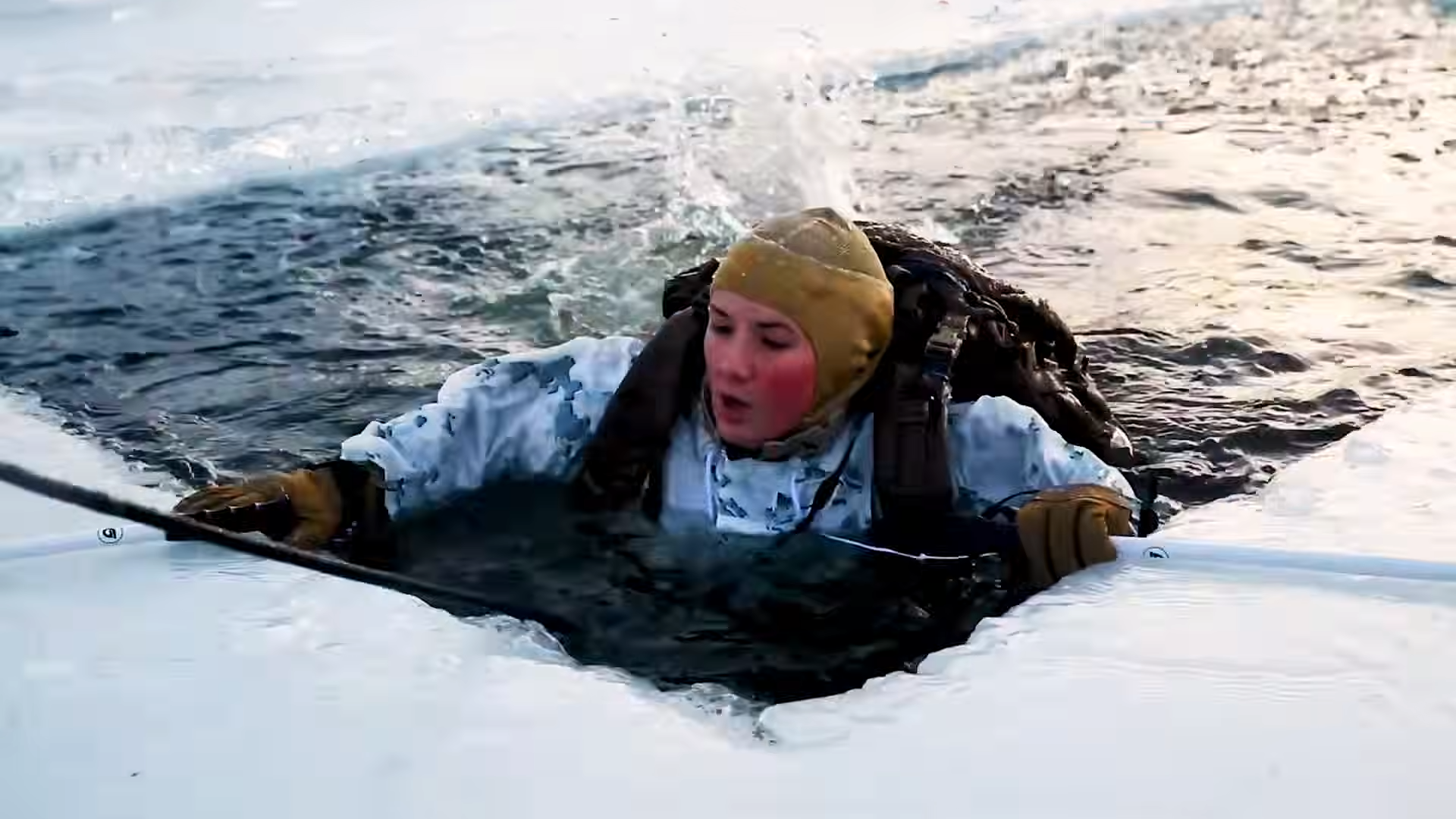 The human body shuts down below 35°C - but she survived at 13°C