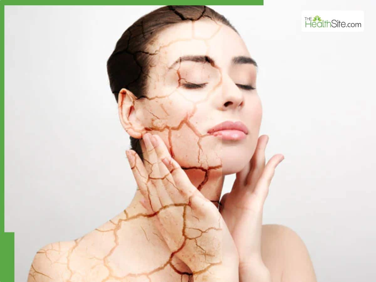 5 hidden side effects of excessive AC use that can harm your skin ...