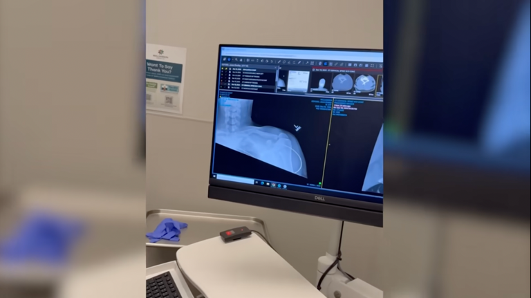 Jelly Roll reveals heartbreaking weight loss setback following painful ...