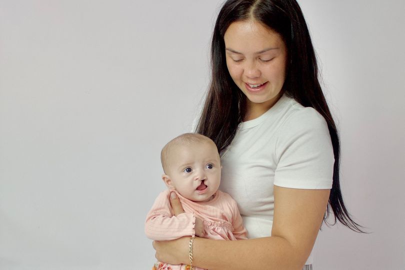 Midland mum 'didn't recognise own baby after doctors operated on her face'