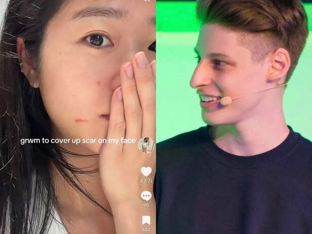 Evelyn Ha's bruised face photos resurface as ex-boyfriend Ben Pasternak ...