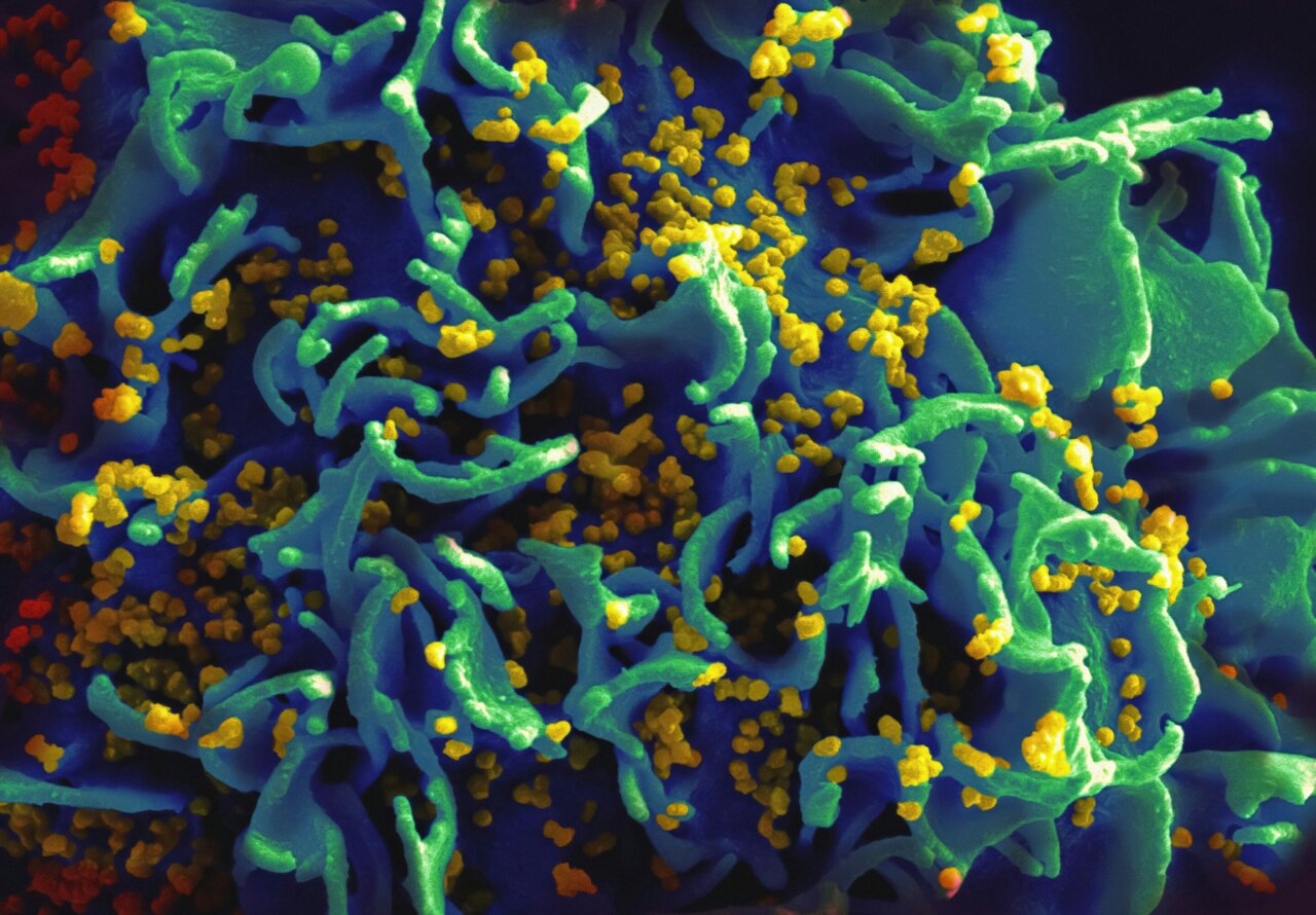 New HIV vaccine design trains immune system to hit shared viral target ...