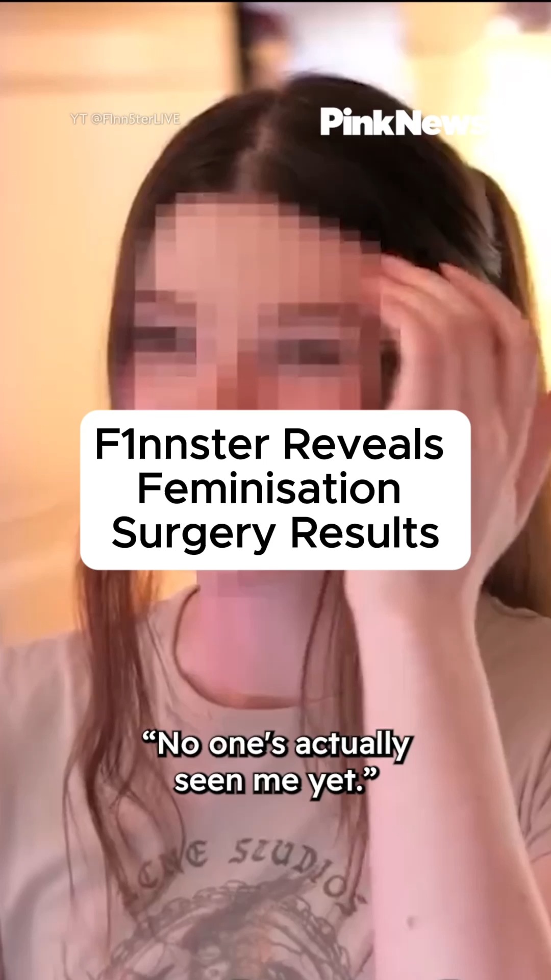Genderfluid streamer Finnster unveils new look after facial ...