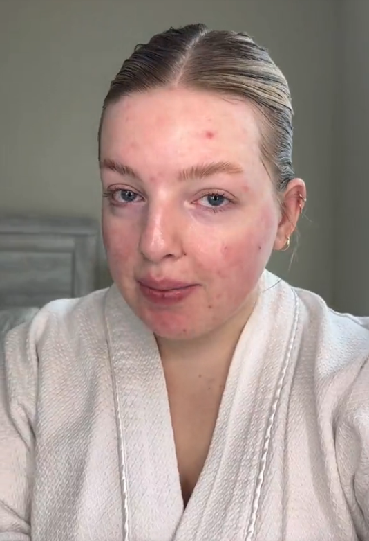 Skin is glowing, baby radiant GRWM