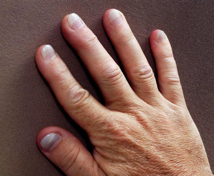 50 health warning signs you should never, ever ignore, straight from ...
