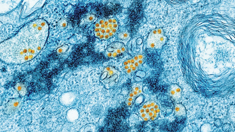 Tests show top AI models can provide step-by-step bioweapons guidance