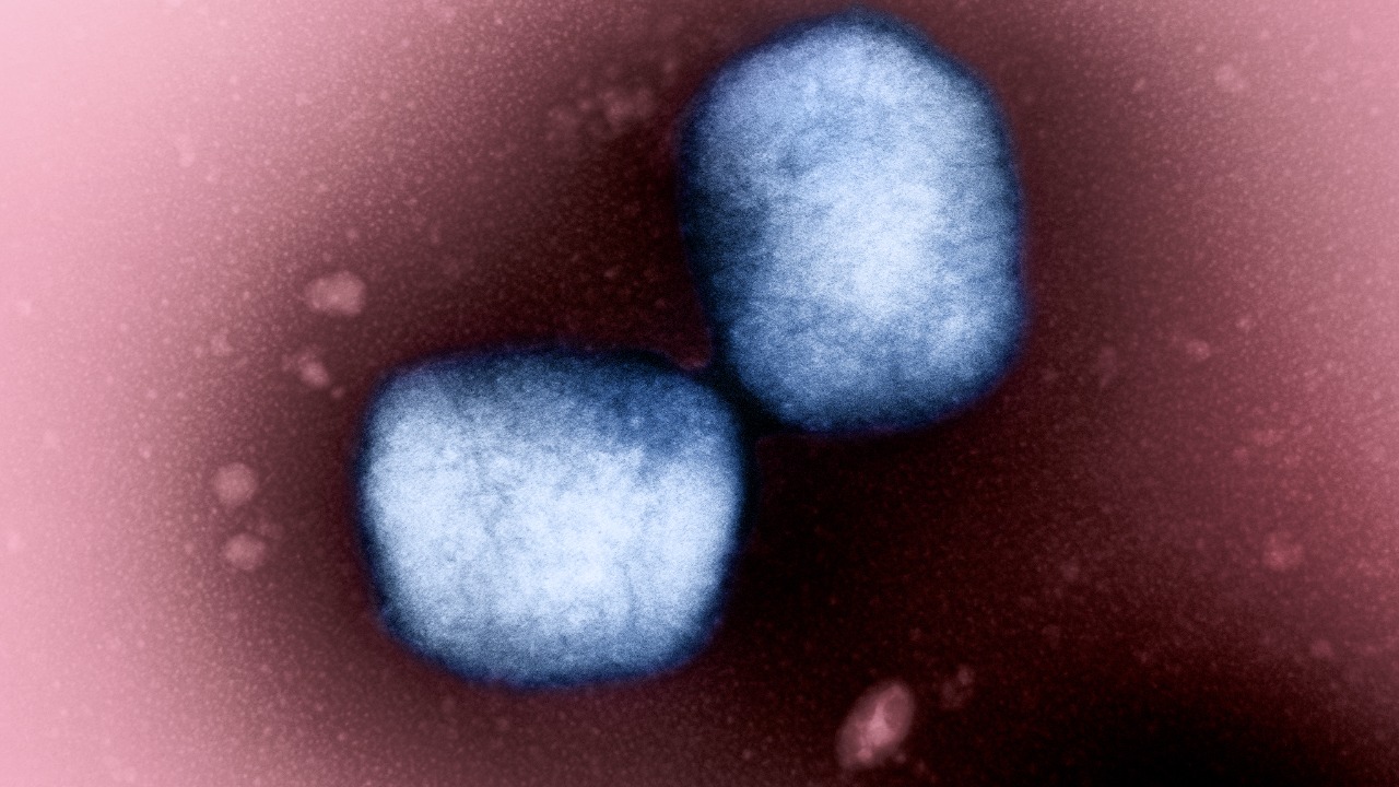 MPOX detected in Pearl Harbor-area wastewater; Hawaii says public risk low