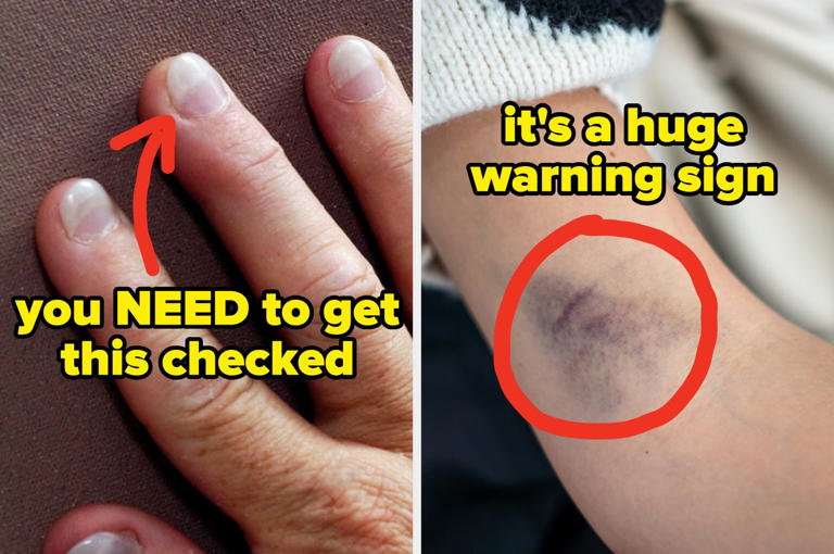 50 health warning signs you should never, ever ignore, straight from ...