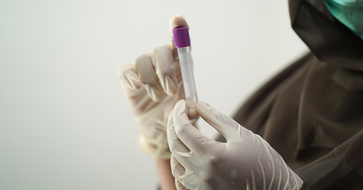 Η άνοια μπορεί να διαγνωστεί με ένα τεστ αίματος δεκαετίες νωρίτερα ...