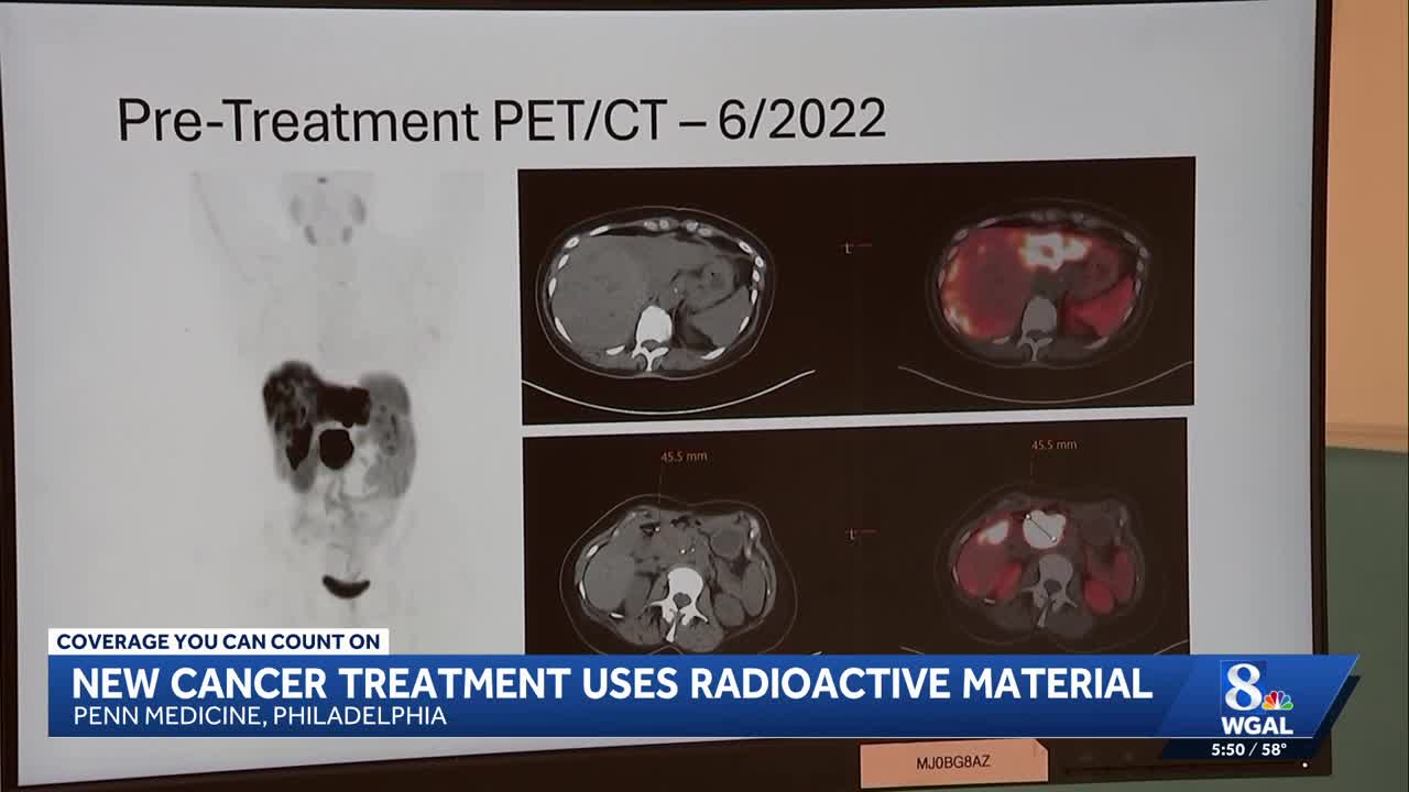 Penn Medicine uses nuclear medicine to treat cancer patients