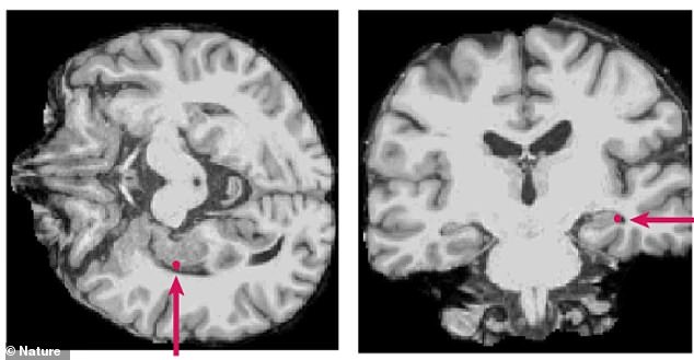 Brains can process language while unconscious - and it could explain ...