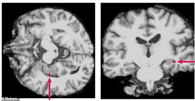 Brains can process language while unconscious - and it could explain ...
