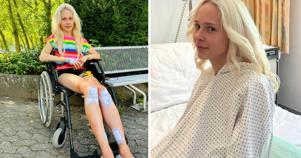 Woman left with deep regret after $161,000 surgery to extend her legs ...