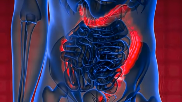 Low LDL isn’t a force field against heart disease