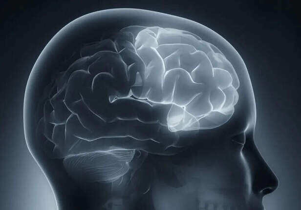 Frontal lobe breakups: Why 20-somethings rethink love