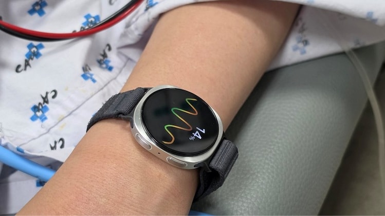 This Samsung smartwatch can predict fainting minutes in advance: Study