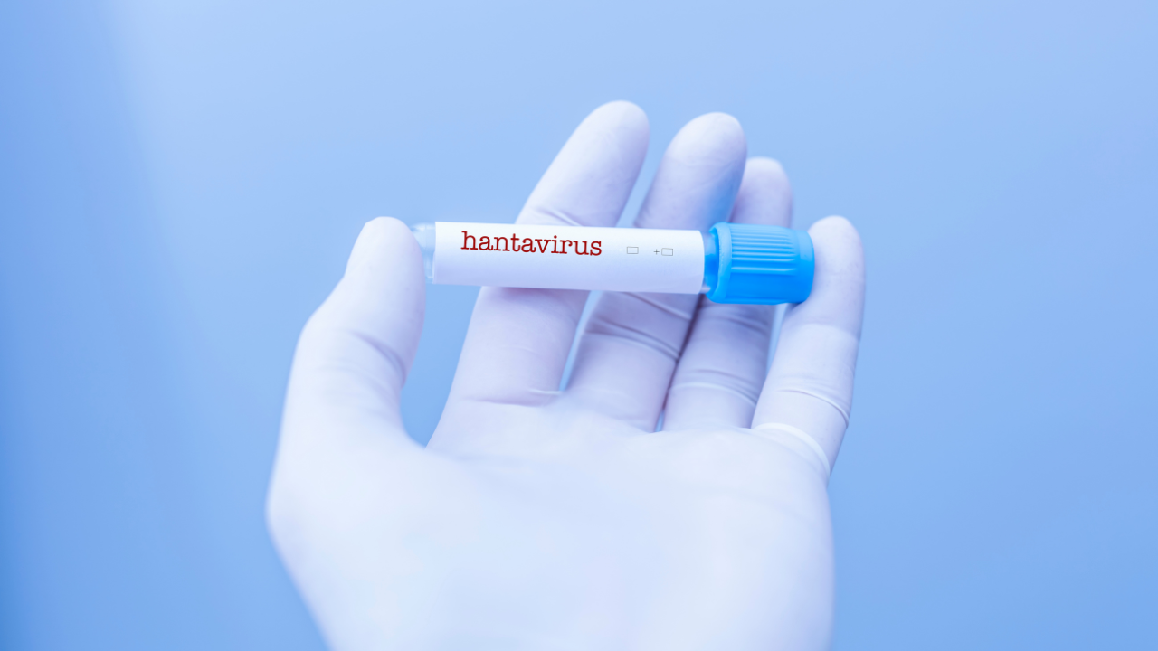 Hantavirus symptoms may look mild at first, but doctors say kidneys and ...