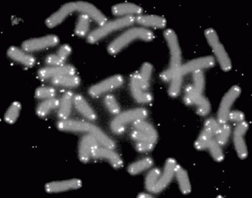 Why unusually long telomeres could raise lymphoma risk and reshape ...