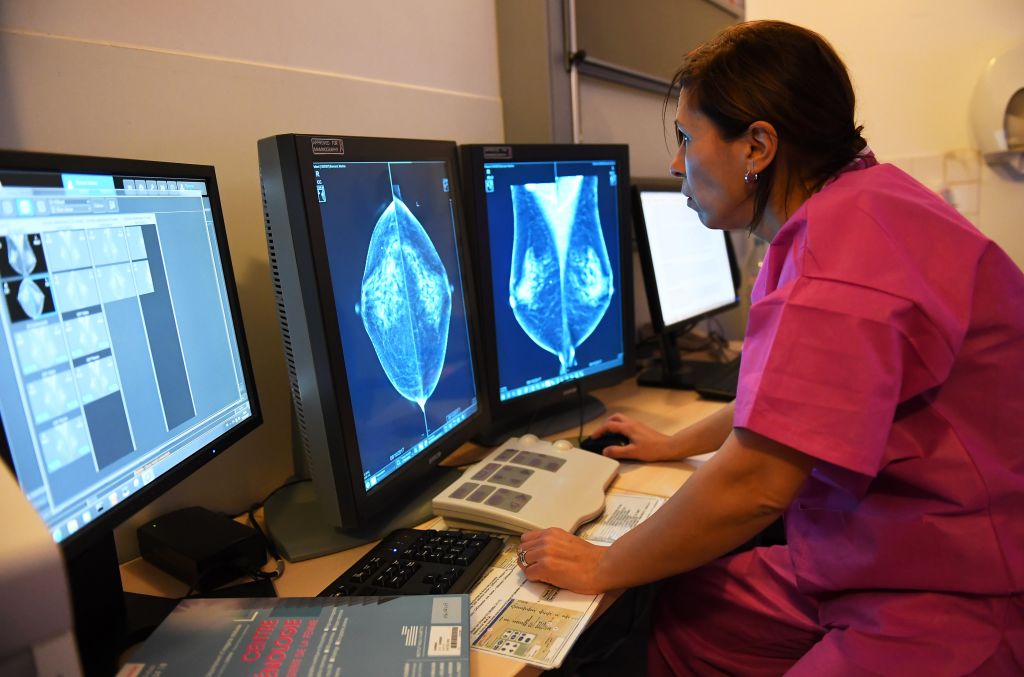 What women 50+ need to know about new mammogram guidelines