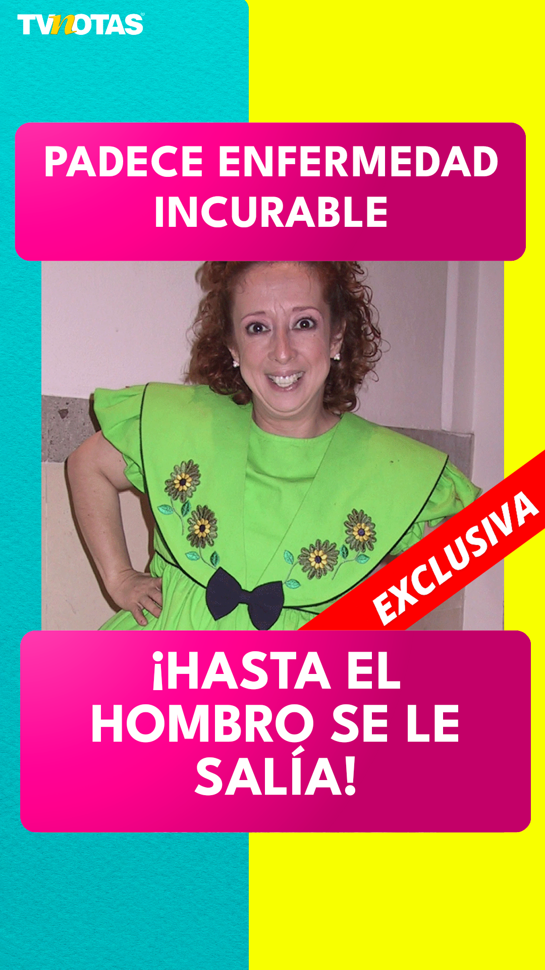 María Elena Saldaña 'La Güereja' revela cómo es vivir con hiperlaxitud ...