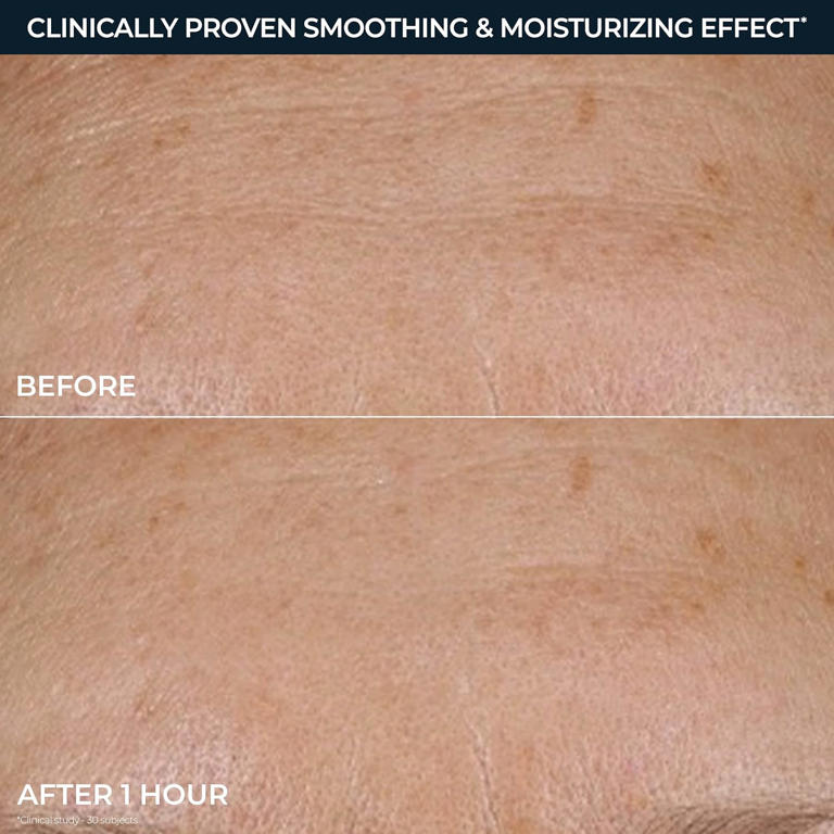I tried RoC’s cooling serum stick for skin flare-ups – here’s what happened