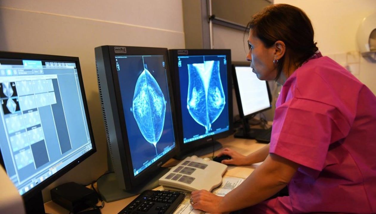 What women 50+ need to know about new mammogram guidelines