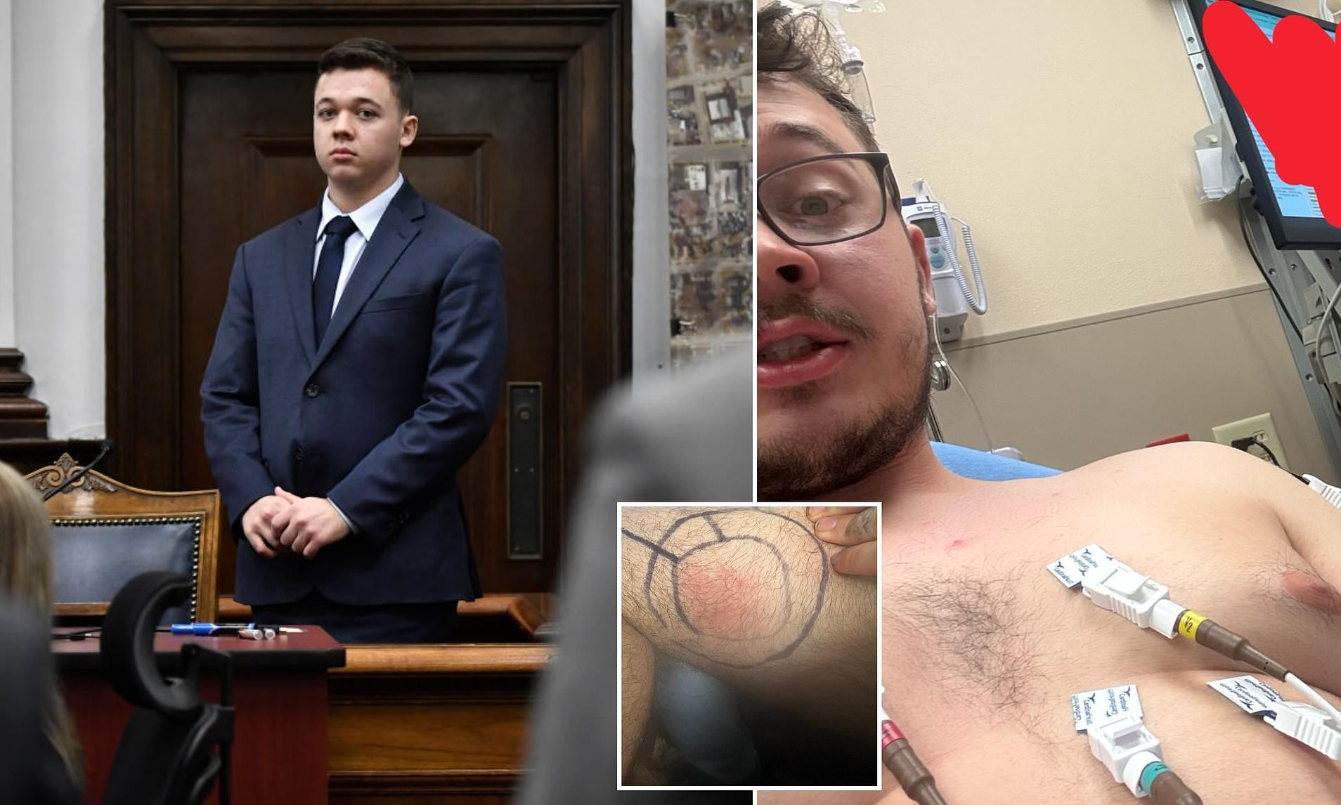 Kyle Rittenhouse hospitalized after nasty venomous spider bite