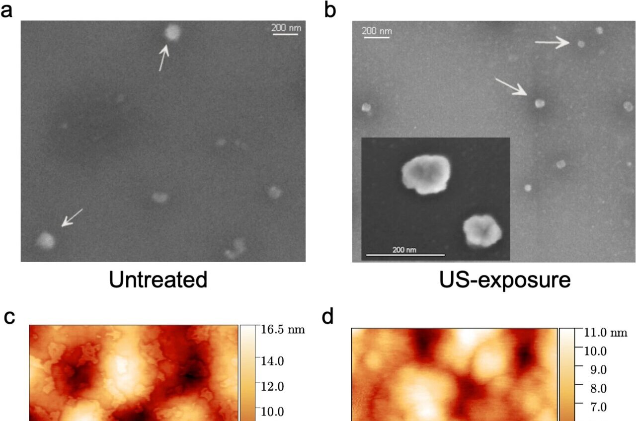 Ultrasound waves rupture COVID-19 and flu viruses without damaging cells