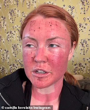 Chris Robshaw's wife Camilla shows off her glowing skin days after ...