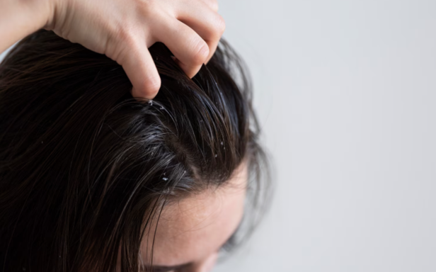 Why your hair looks oily just one day after washing
