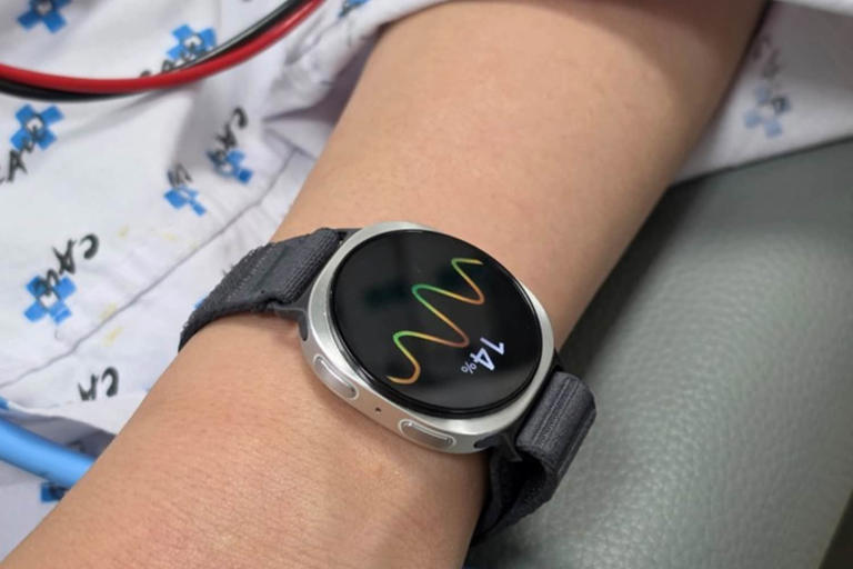 Fainting prediction will be the next major Samsung Galaxy Watch health ...