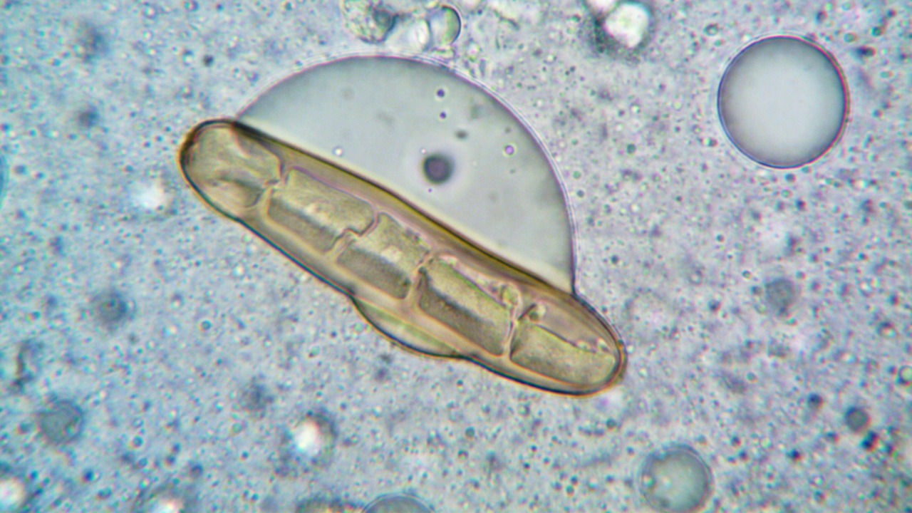 A bizarre genetic code found in a microscopic pond organism is ...
