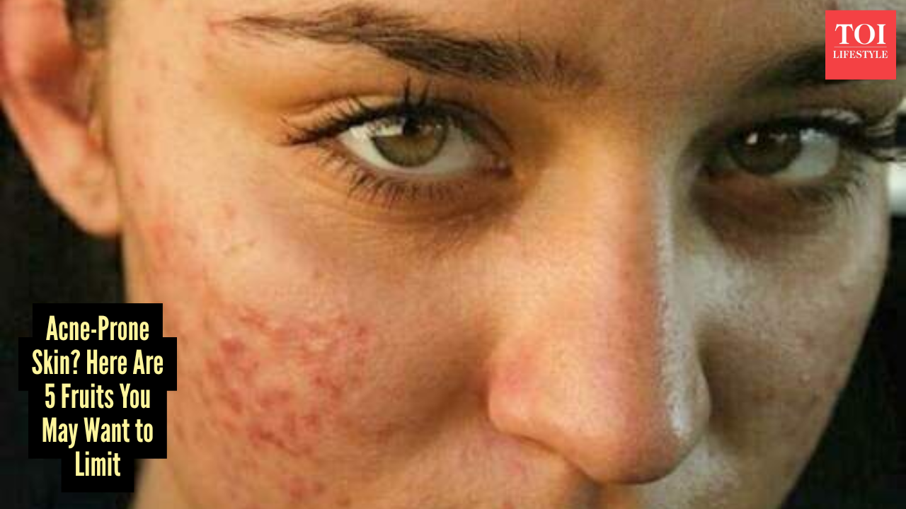 5 fruits that could be triggering your acne