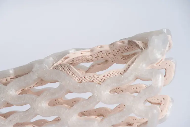 This 3D-printed cast shapes to your arm—and makes healing a broken bone ...