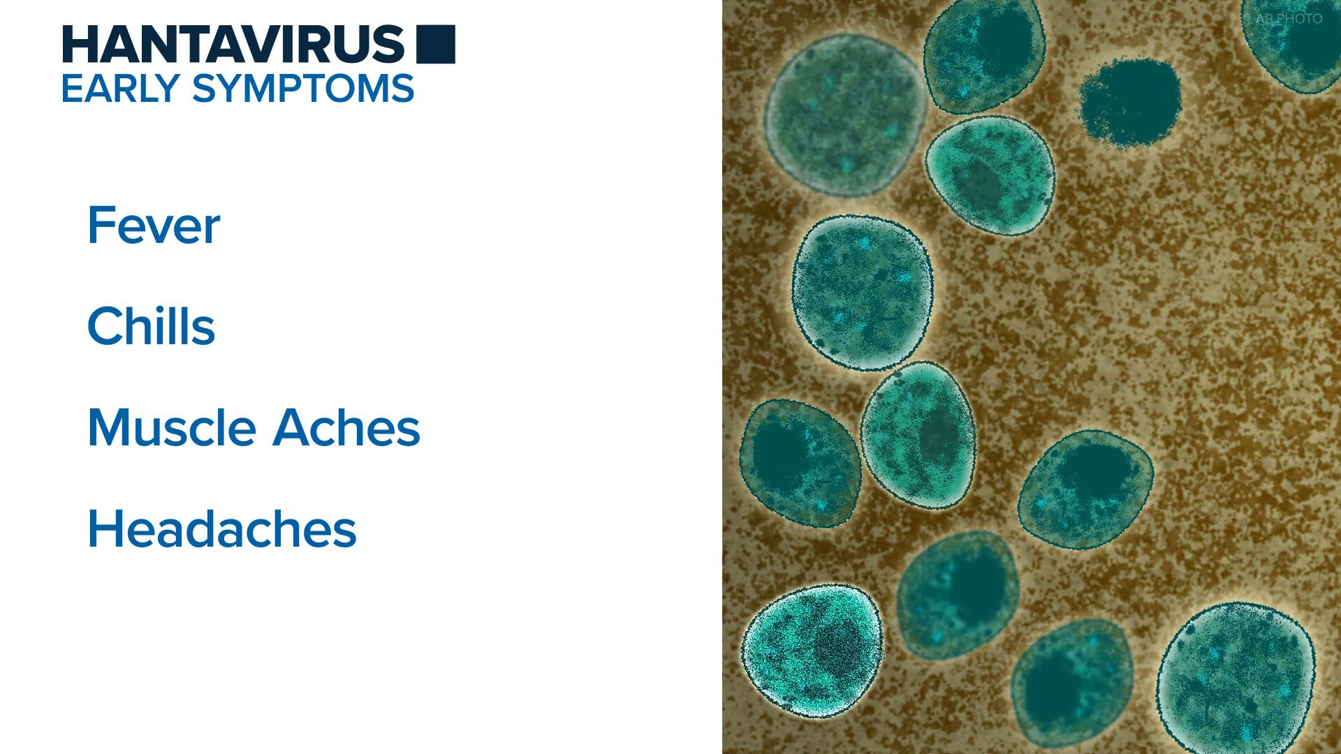 Texas officials monitor cruise passengers after hantavirus outbreak