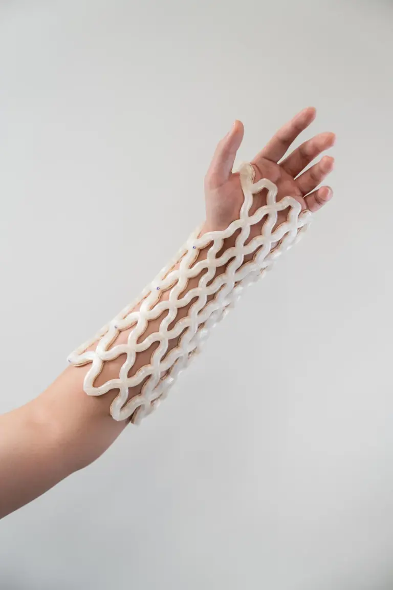 This 3D-printed cast shapes to your arm—and makes healing a broken bone ...