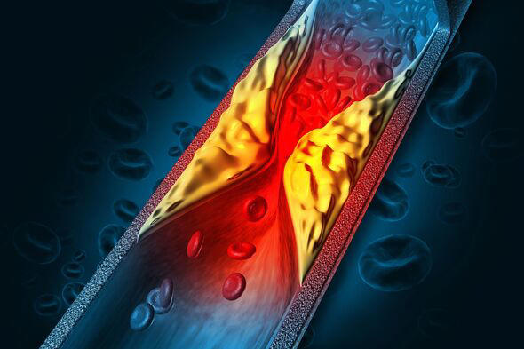 I'm a doctor - this two-minute habit could help bring down cholesterol ...