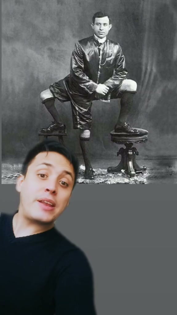 La vida normal de Frank Lentini #storytime #relatos #historia #curio