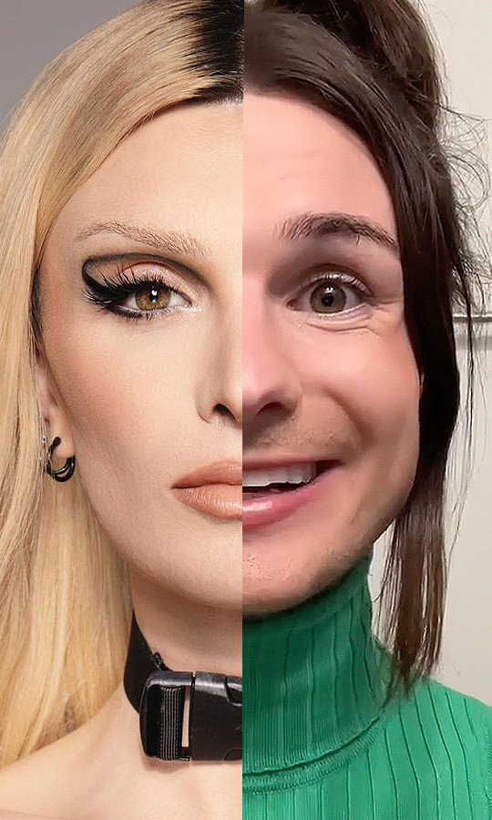 Dylan Mulvaney’s facial feminisation transformation