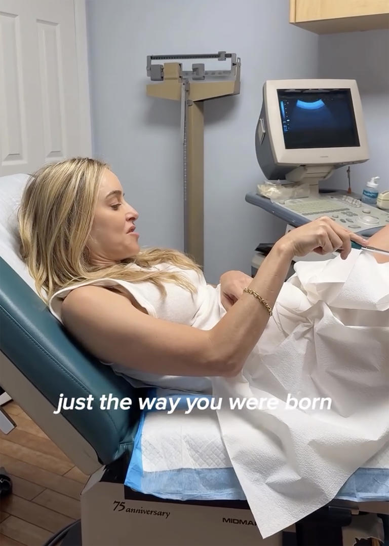 Jenny Mollen Reveals She Recently Underwent Popular Celebrity Surgery