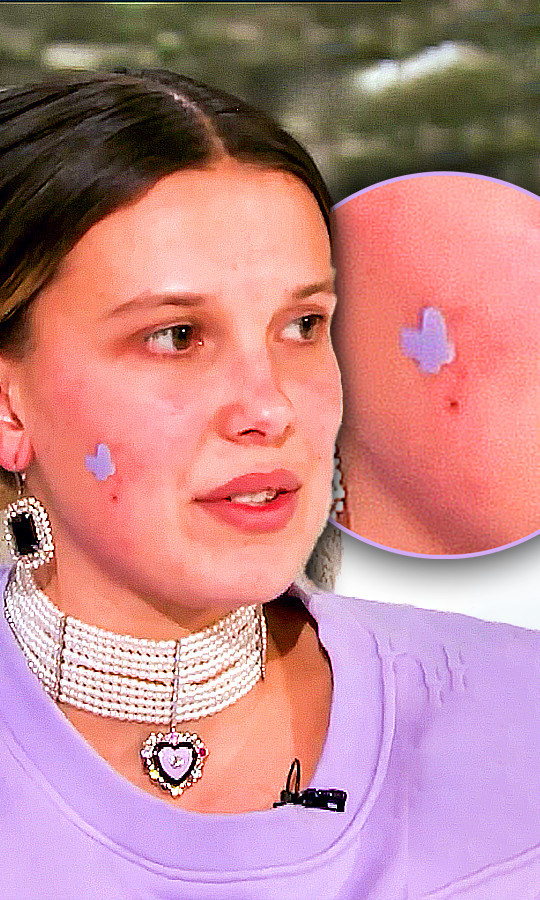 Millie Bobby Brown shows her real skin ️