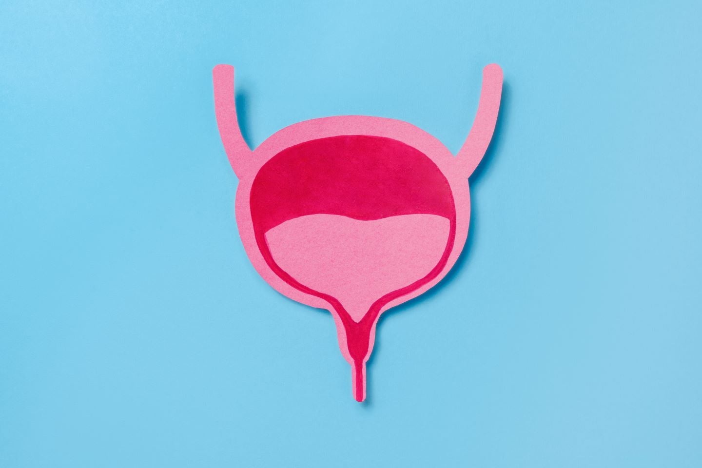 FDA clears Bright Uro’s abdominal sensor for evaluating bladder dysfunction