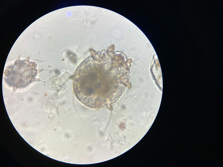 Outbreak of horrific skin-eating disease at California school