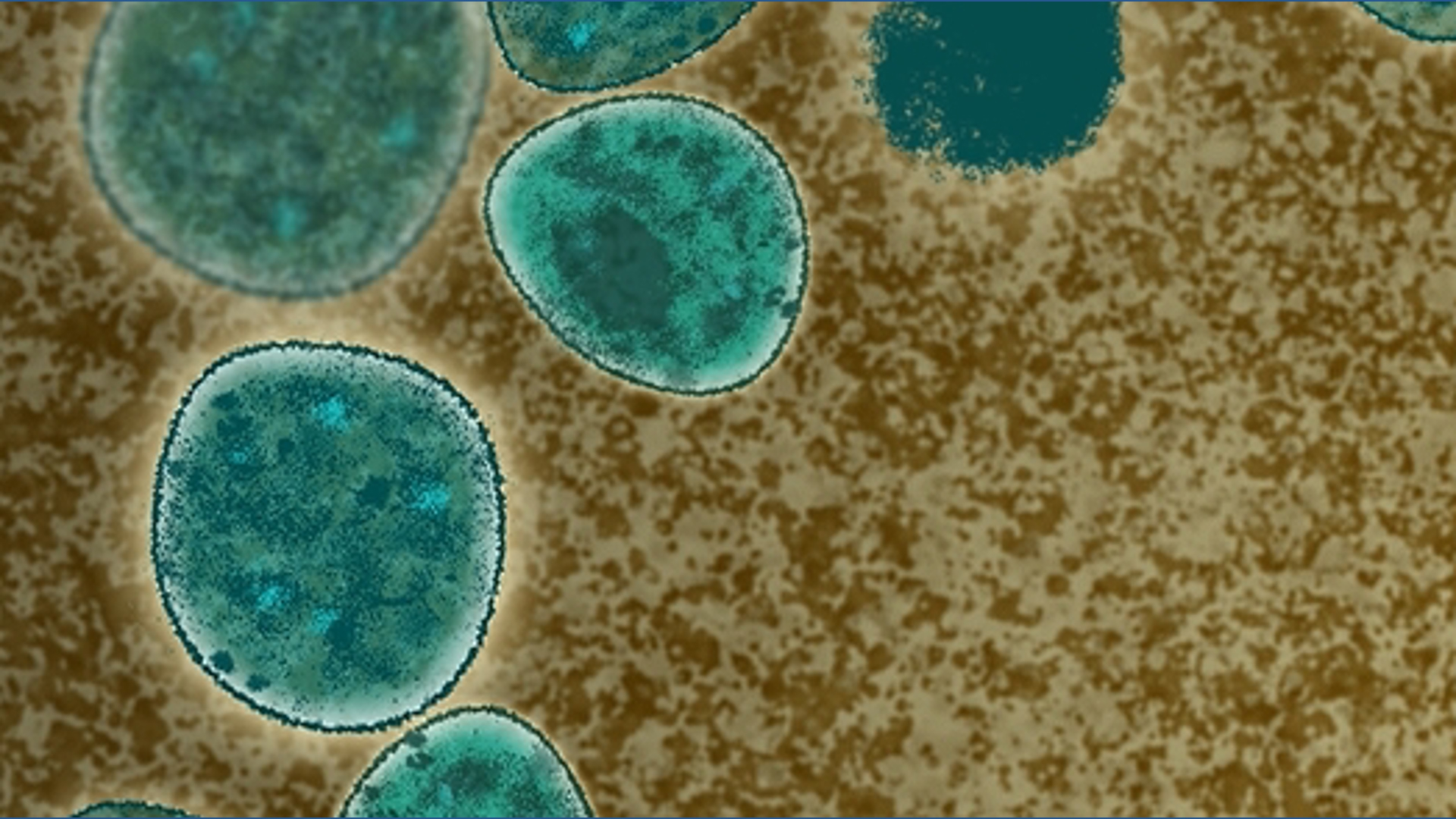 Hantavirus | It can start like a bad flu then quickly turn into a ...