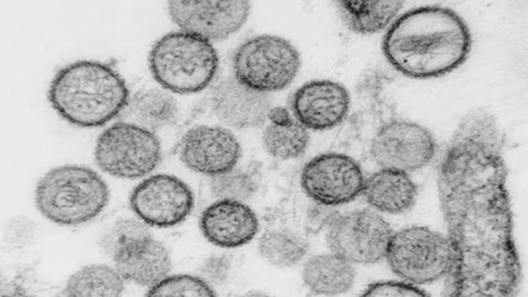 Hantavirus searches spike in Alabama as health officials say no cases ...