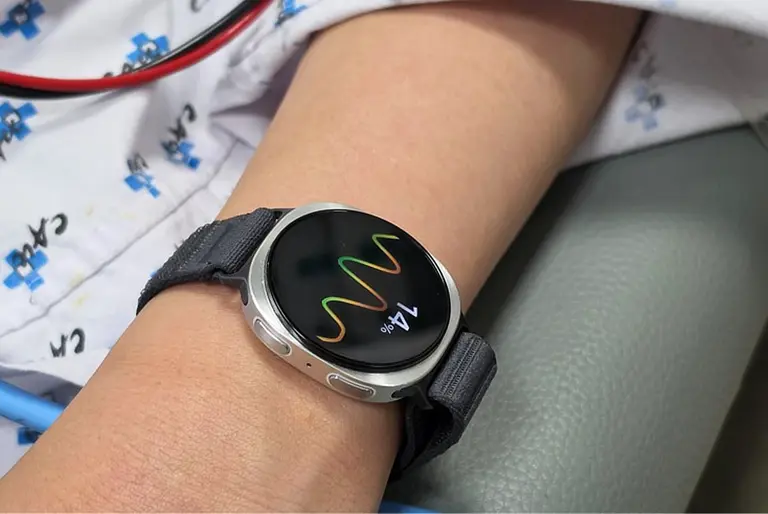 Samsung Galaxy Watch can predict fainting, confirmed by Korean study