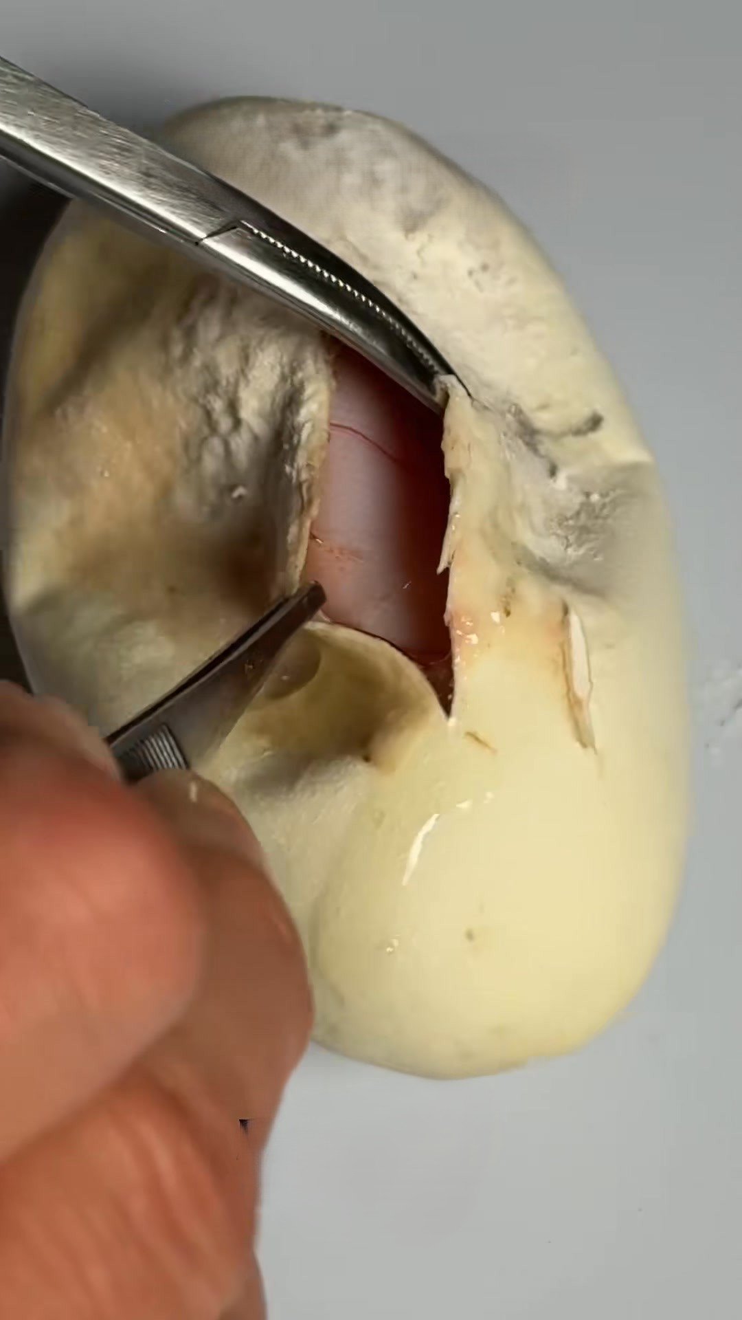 Helping a patched-up egg pip