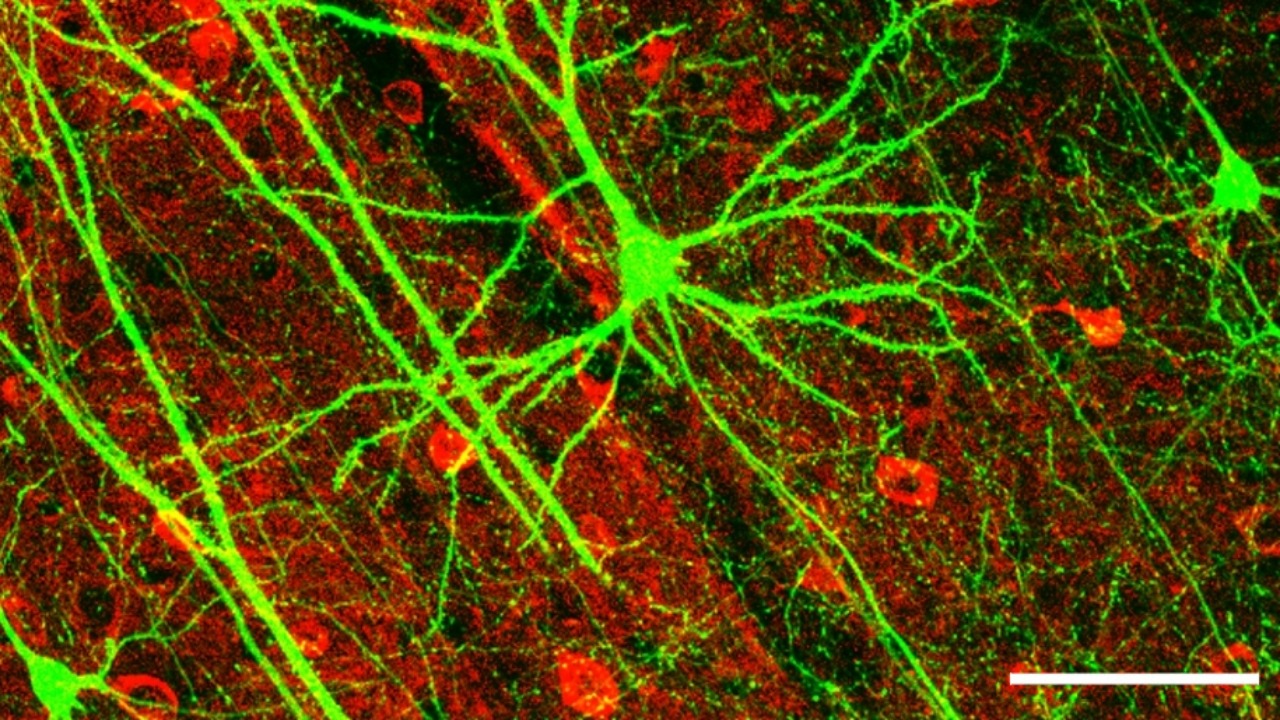MIT discovers 30% of your brain’s synapses are 'silent' — dormant ...
