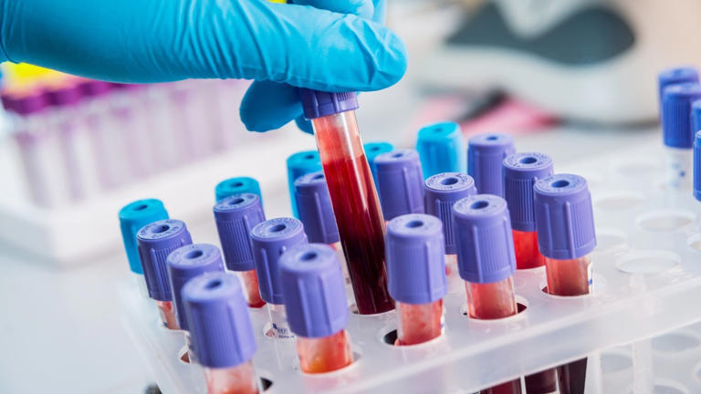 Depression may soon be detectable through a simple blood test that ...